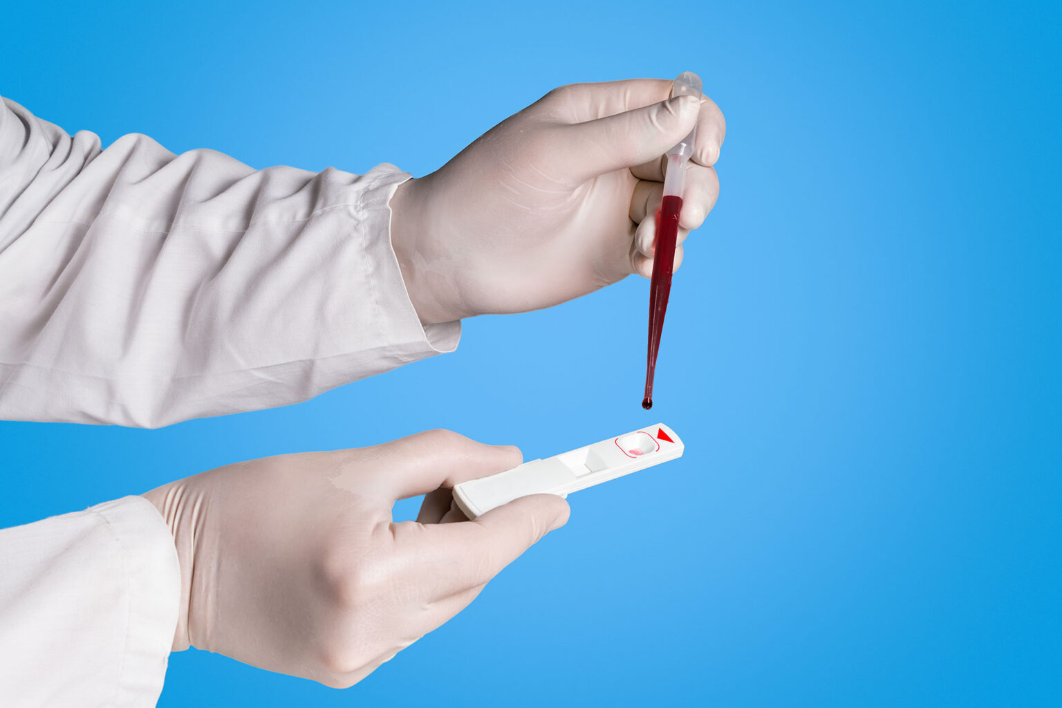 Dengue Virus Real Time RT-PCR Kit – CrossLife Technology